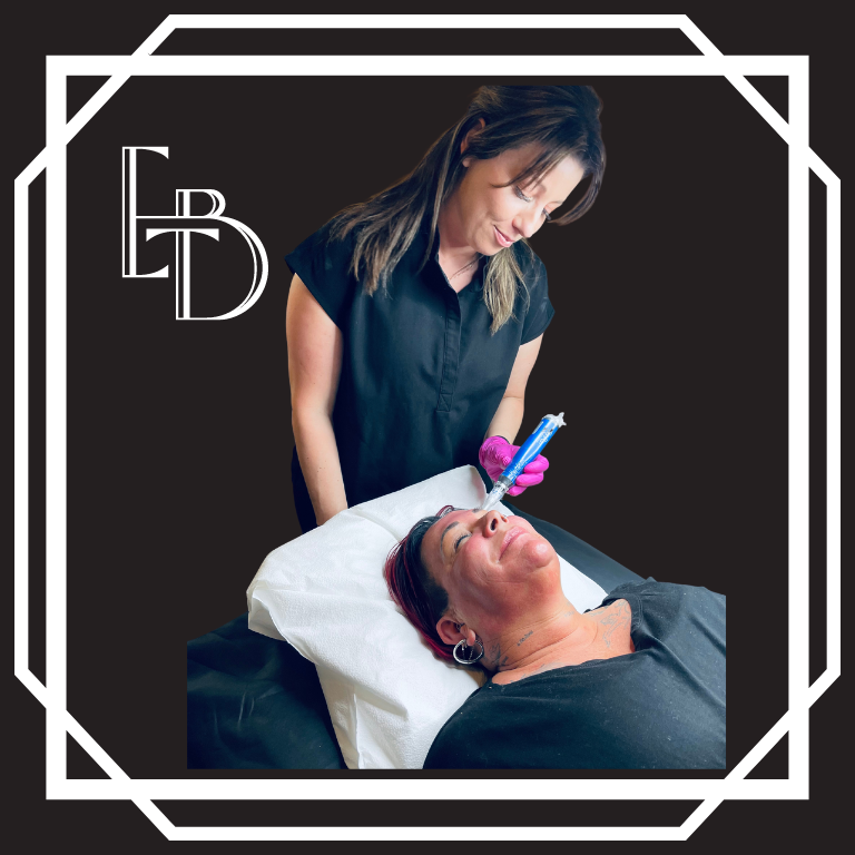 Micro-needling to give your skin a more youthful appearance