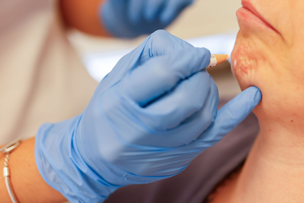 Nurse Practitioner-Led Med Spa Results | Look Timeless