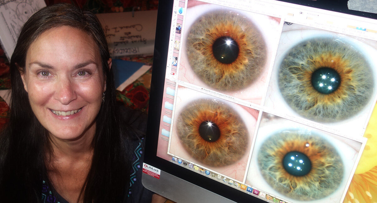 Pure Naturopathy School I Iridology Consultation