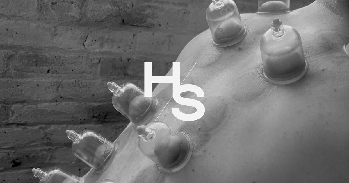 Services | Haystack Acupuncture, Cupping and Ear Seeds