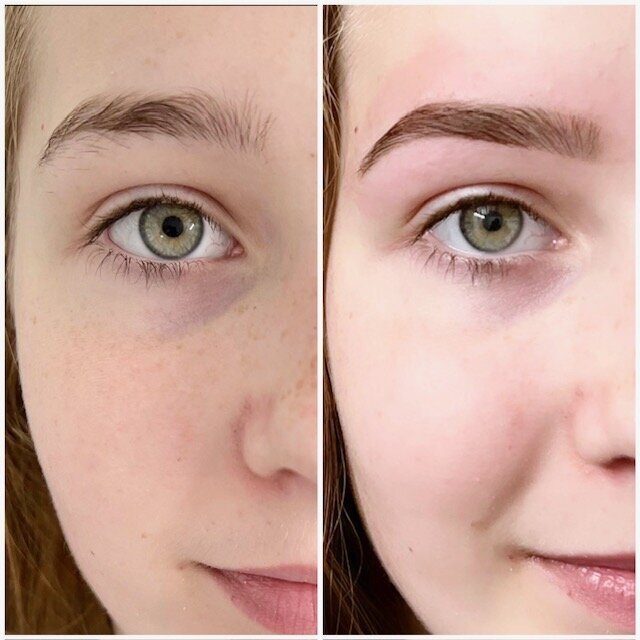 Brow, Lashes, Facials, and Waxing Services | Loft Esthetics | Calgary, AB