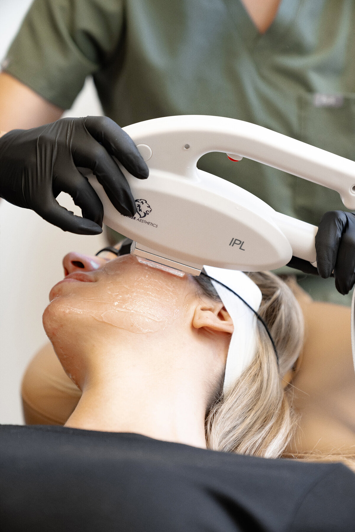 Laser Skin Resurfacing Charleston Reagan Aesthetics