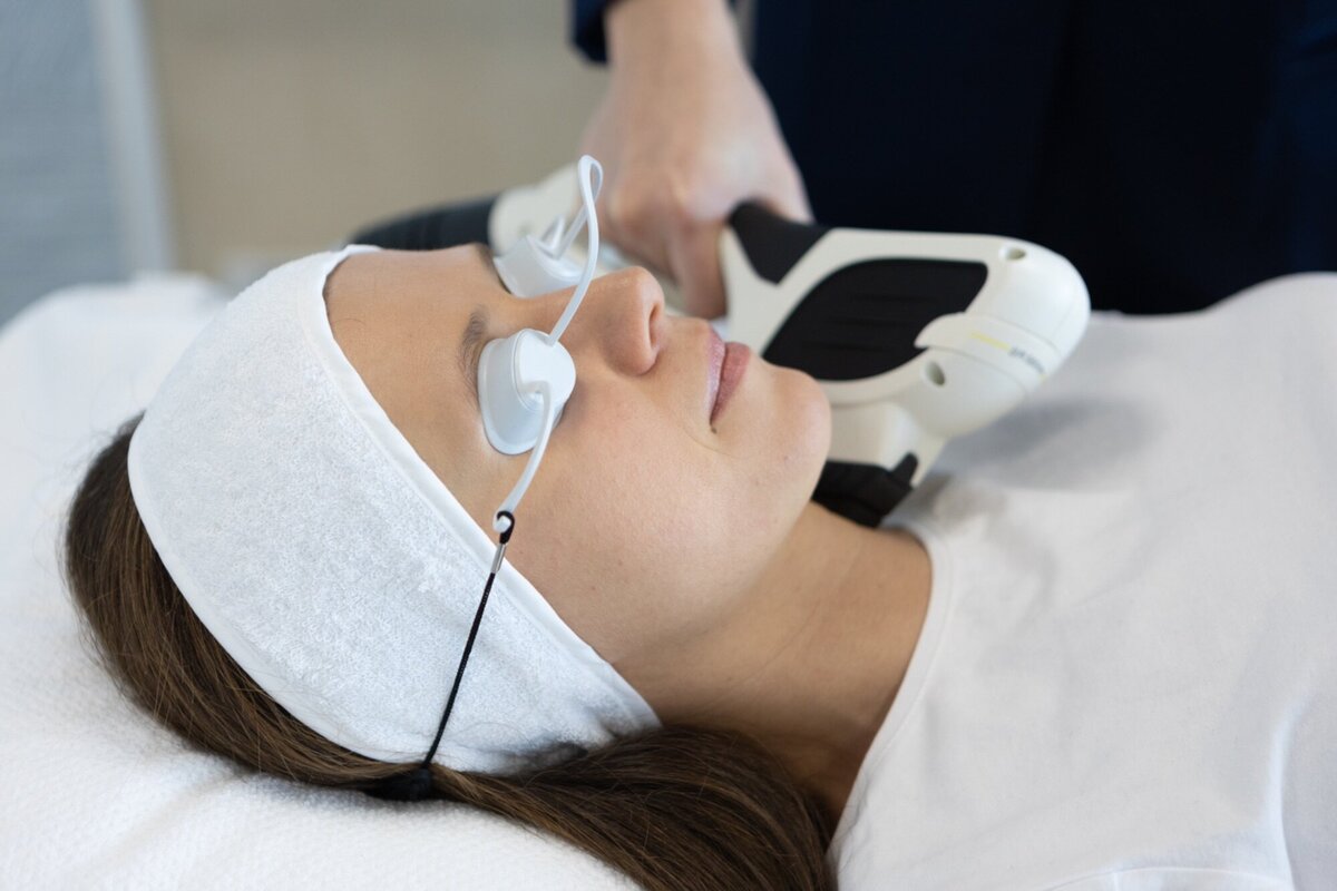 IPL Skin Rejuvenation