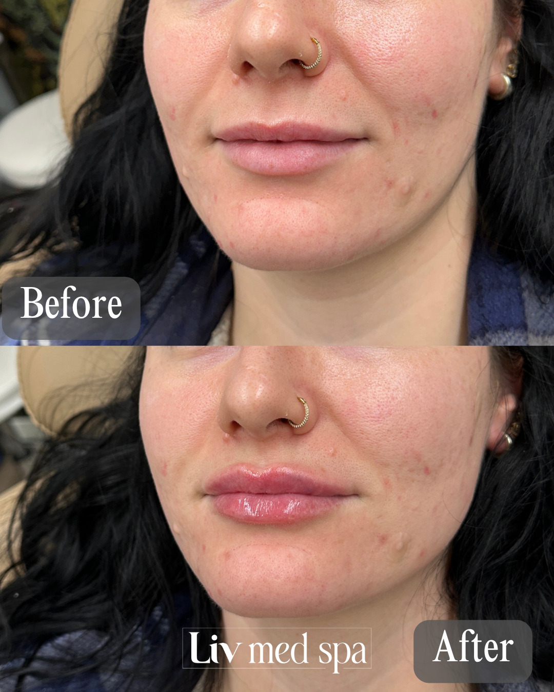 Sioux Falls, SD | Medical Aesthetics & Laser Tattoo Removal
