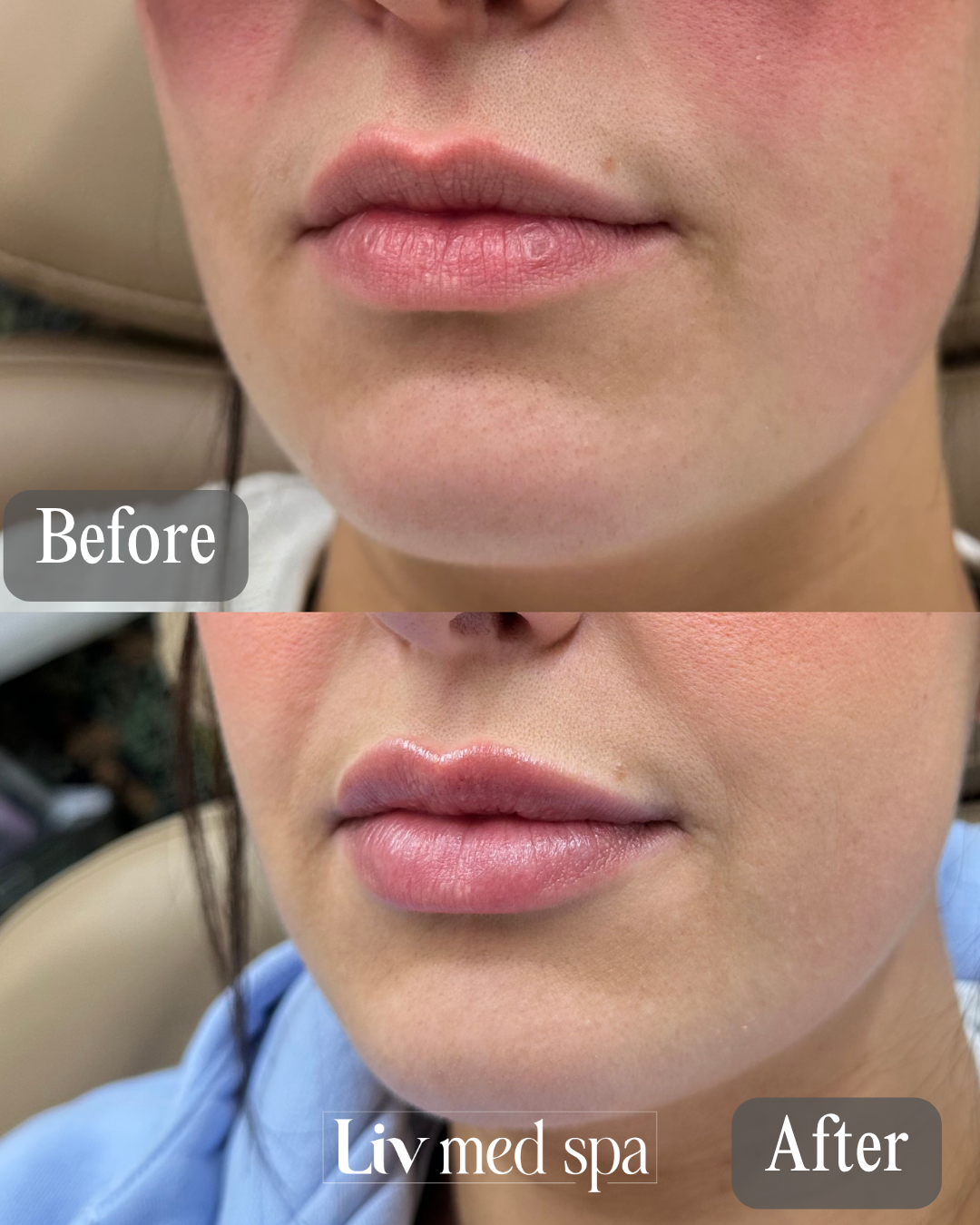 Sioux Falls, SD | Medical Aesthetics & Laser Tattoo Removal