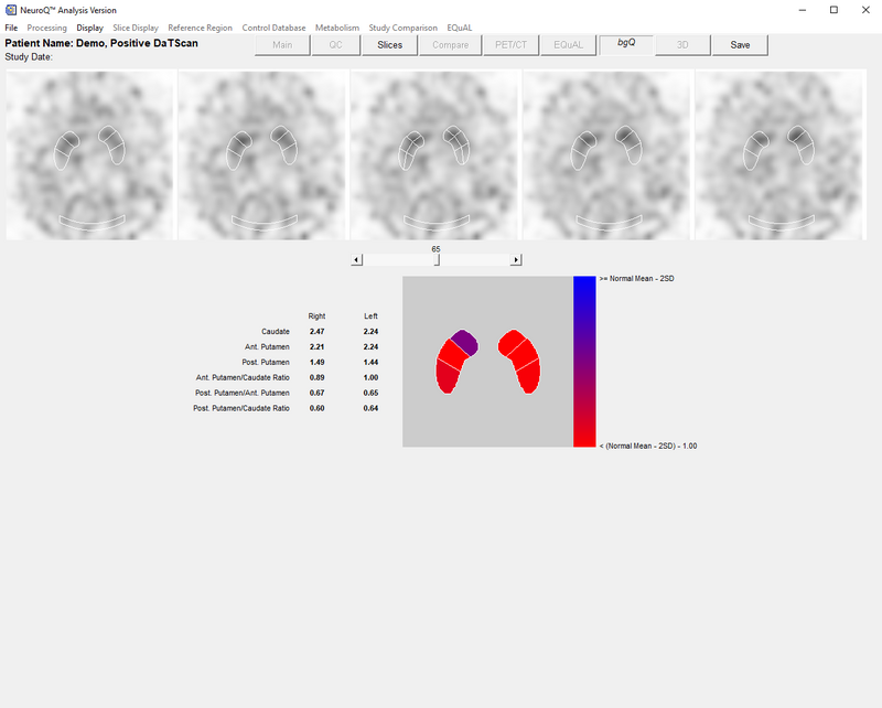 Advanced Brain Tools