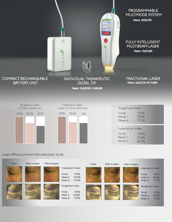 Treatments | MultiFrax